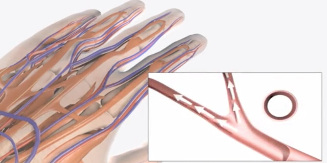 Hand Arm Vibration Awareness - Provided by Health Academy