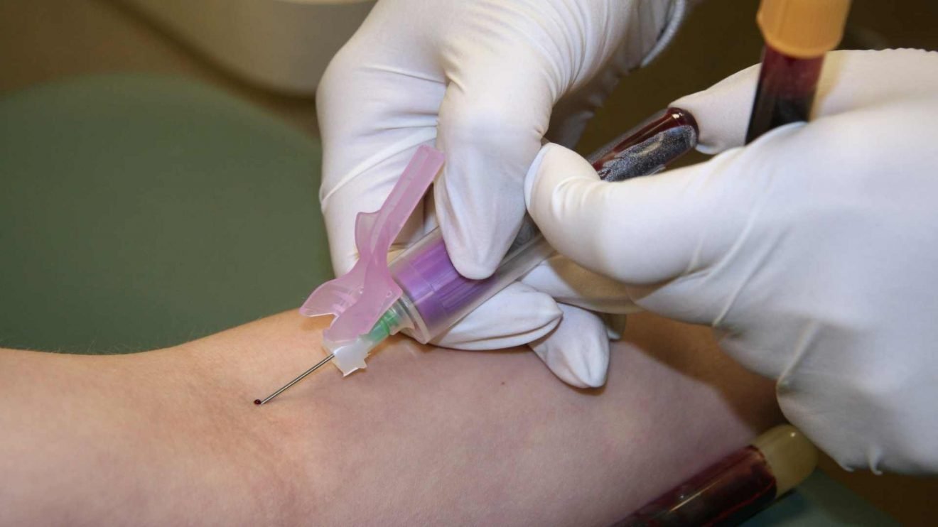 Venepuncture: Can You Gauge What Needle Is Best? - Health Academy