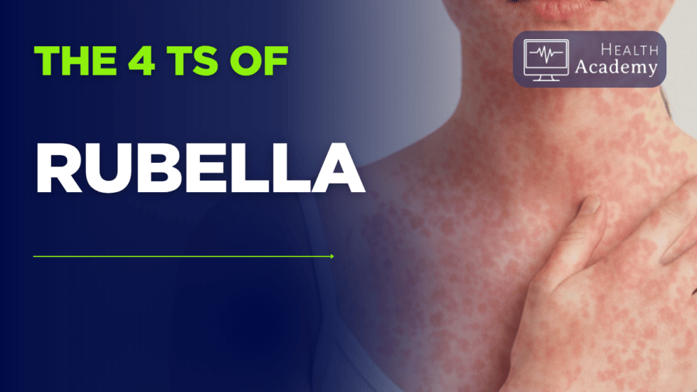 Understanding the 4T's of Rubella - Health Academy